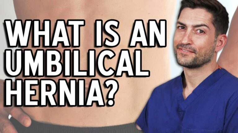 Umbilical Hernia - Symptoms, Causes, and Treatment